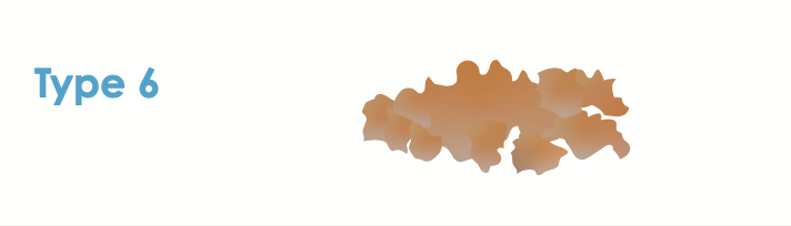 Bristol stool form scale - Bladder & Bowel Community