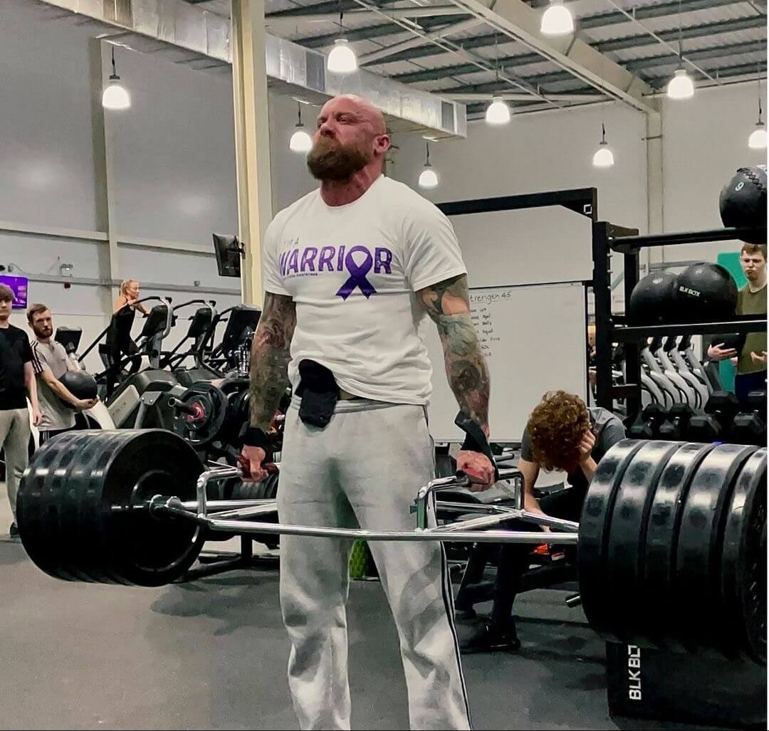 Fitness gave me confidence after stoma surgery | Bladder & Bowel Community